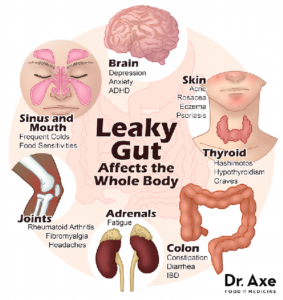 Leaky Gut Syndrome – a real disease entity? - The Namibian