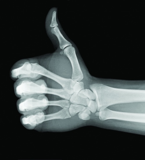 Career Focus: Radiography - The Namibian