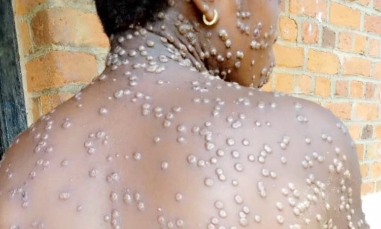 Oministili youndjolowele oya pulwa eenghendabala odo i na po dokukelela ...
